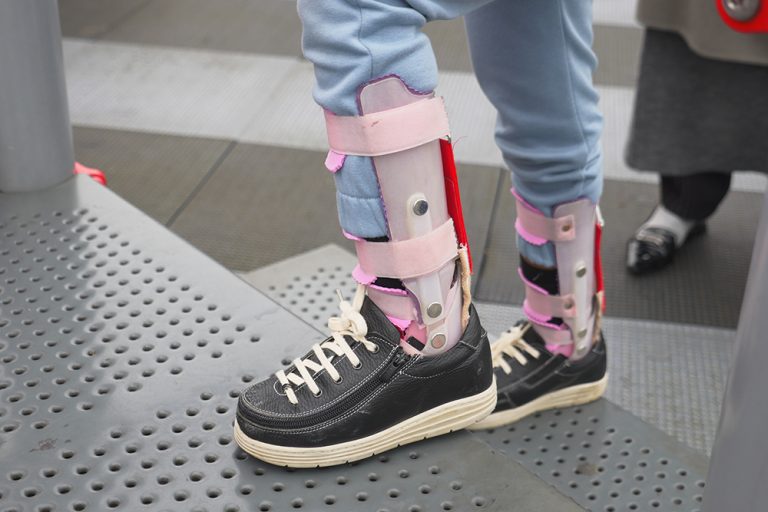 Navigating Mobility Challenges in Limb-Girdle Muscular Dystrophy