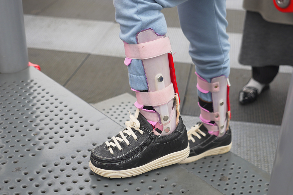 Navigating Mobility Challenges in Limb-Girdle Muscular Dystrophy